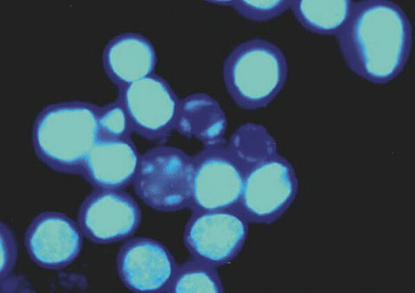 Anti-DNA Antibody, single stranded specific, clone F7-26 | MAB3299